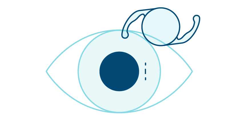 Home | Clearsight - Oklahoma City, OK and Plano, TX
