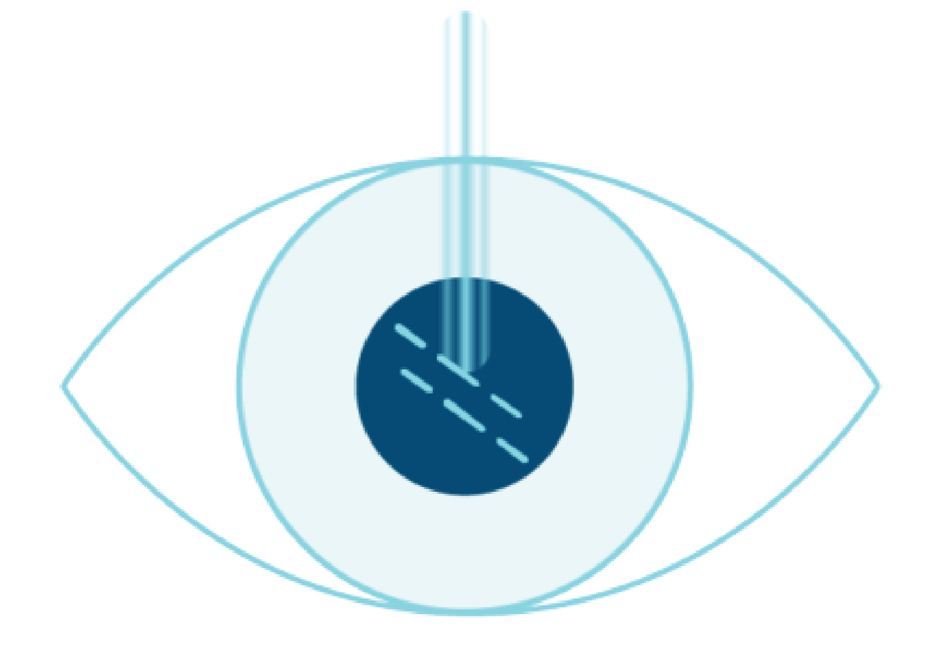 ClearSight LASIK and Lens - Oklahoma City, OK and Plano, TX Vision ...