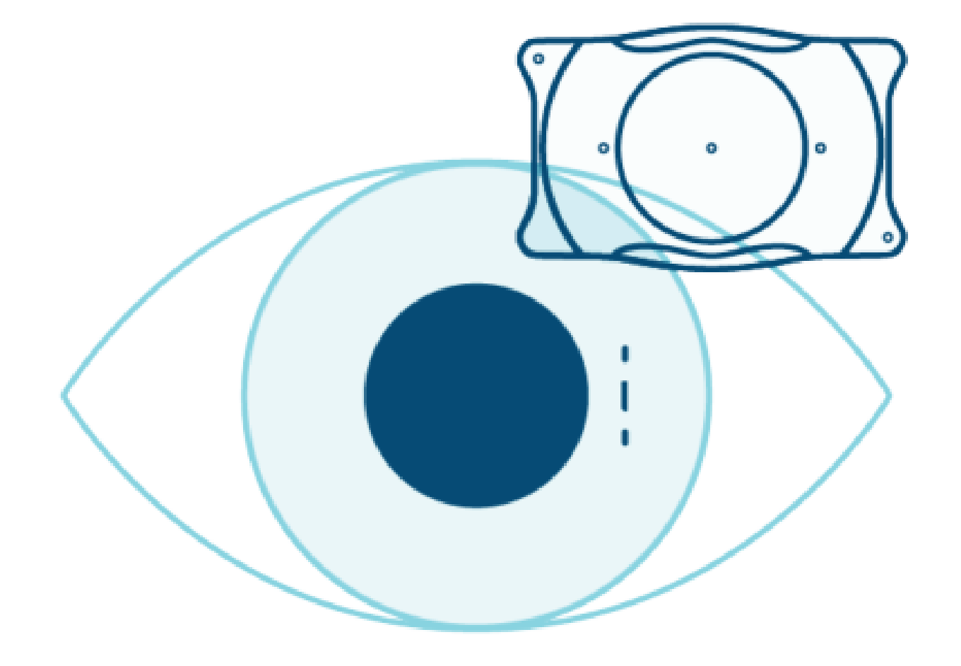 ClearSight LASIK and Lens - Oklahoma City, OK and Plano, TX Vision ...