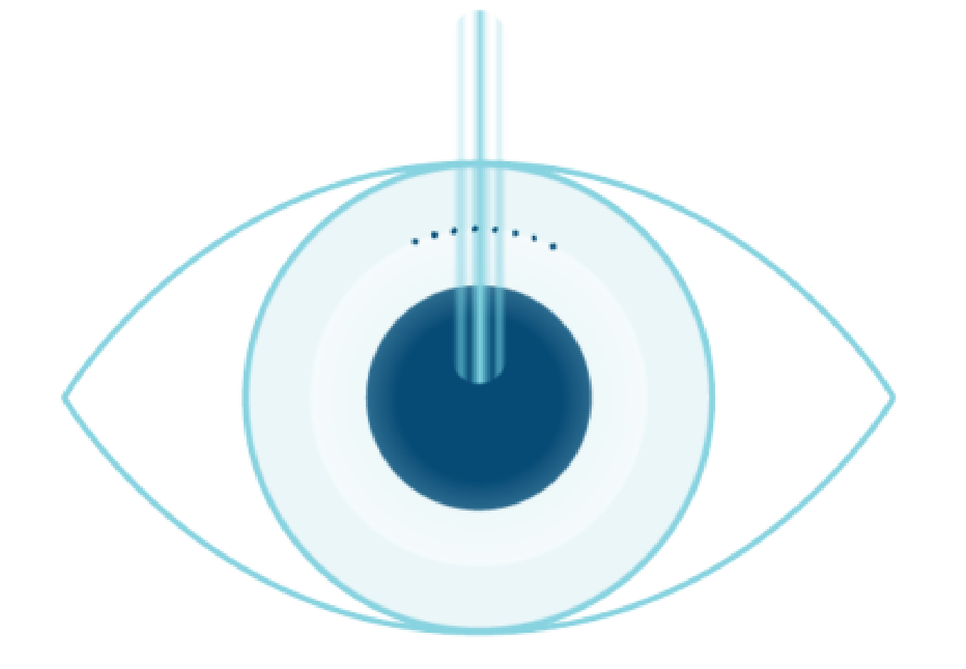 ClearSight LASIK and Lens - Oklahoma City, OK and Plano, TX Vision ...